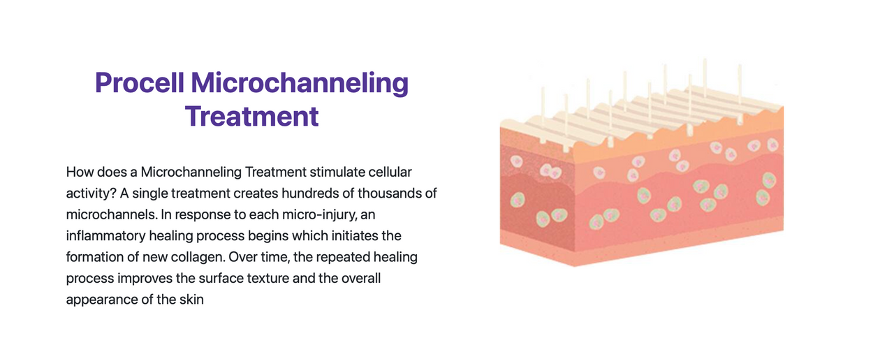 Procell Microchanneling: Microneedling Evolved – RoZ Aesthetics
